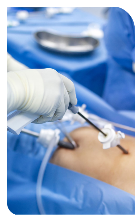 Surgical Procedures - Middle Georgia Surgery Institute