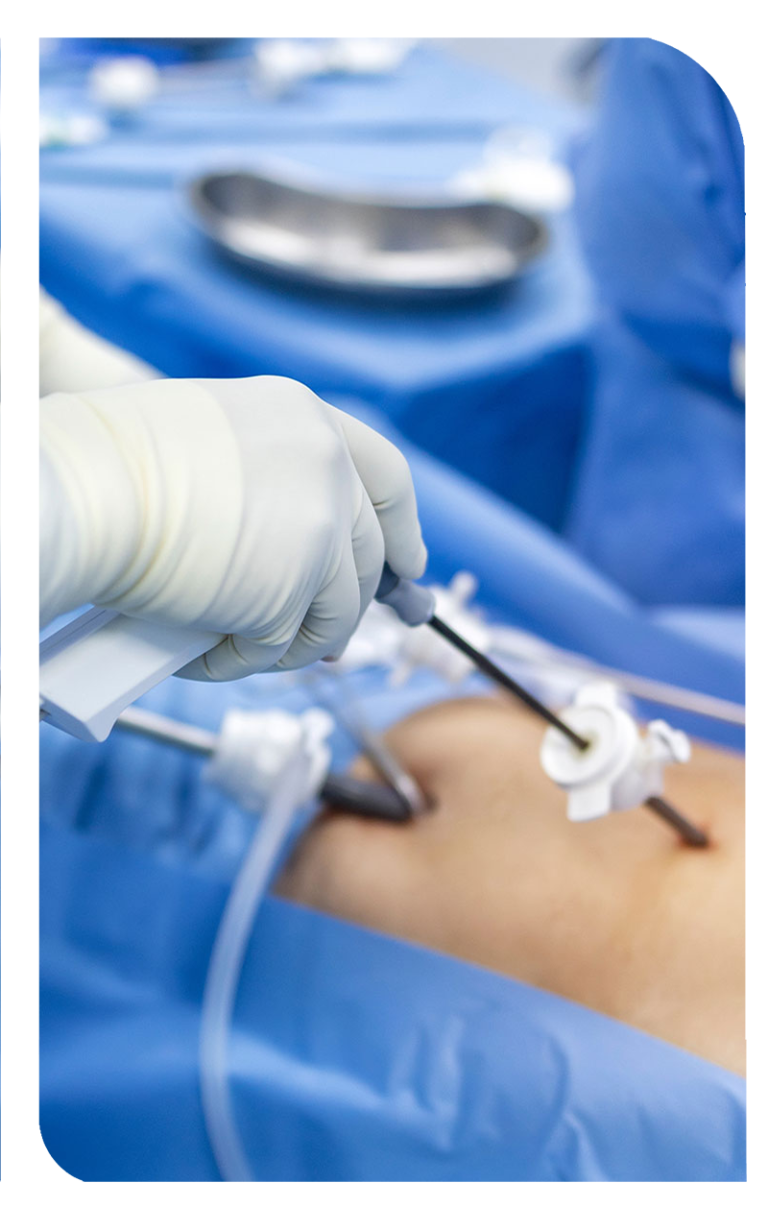 Surgical Procedures - Middle Georgia Surgery Institute